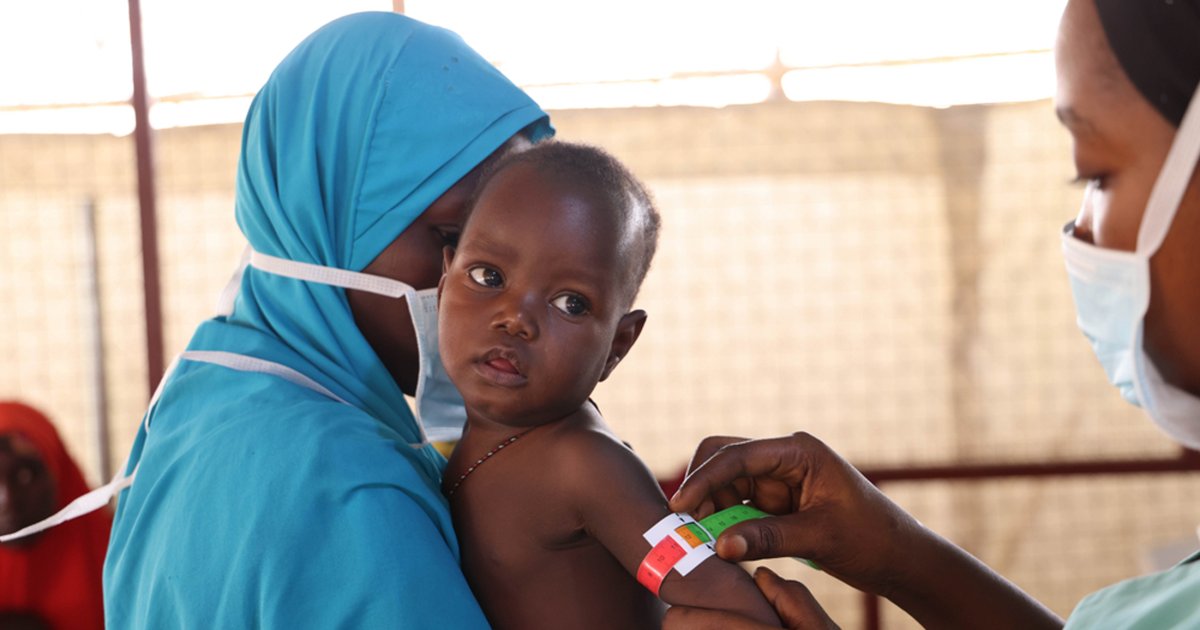 Nigeria: Extreme Mangelernährung unter Kindern in Maiduguri | Ärzte ohne Grenzen (MSF)
